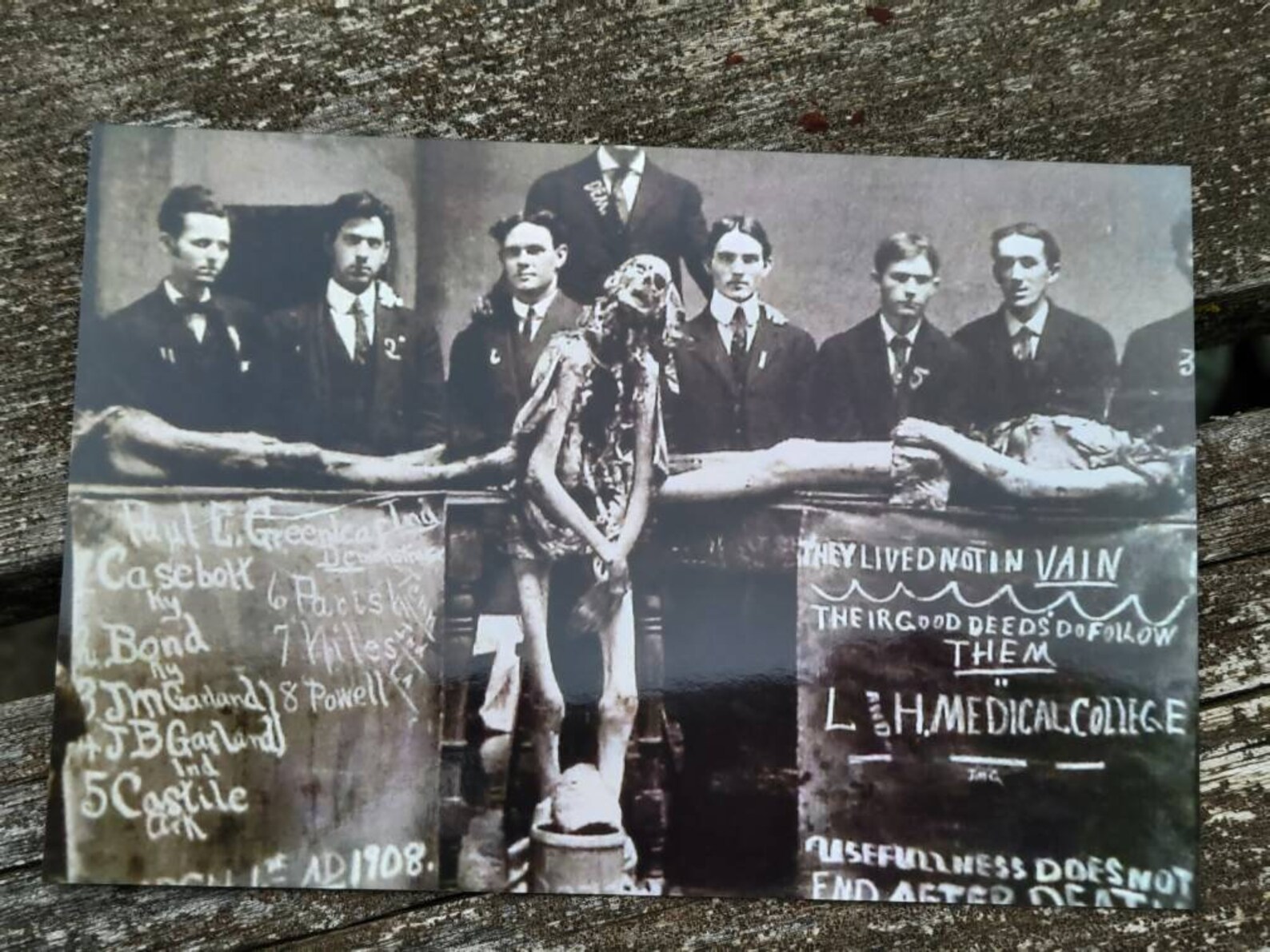 1900's Autopsy Medical Class Reprint Black and White - Etsy