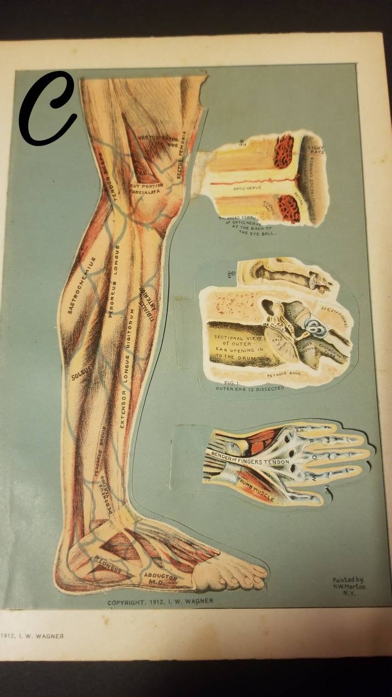 Antique Medical Overlays Book Plate Medical Lithographs - Etsy