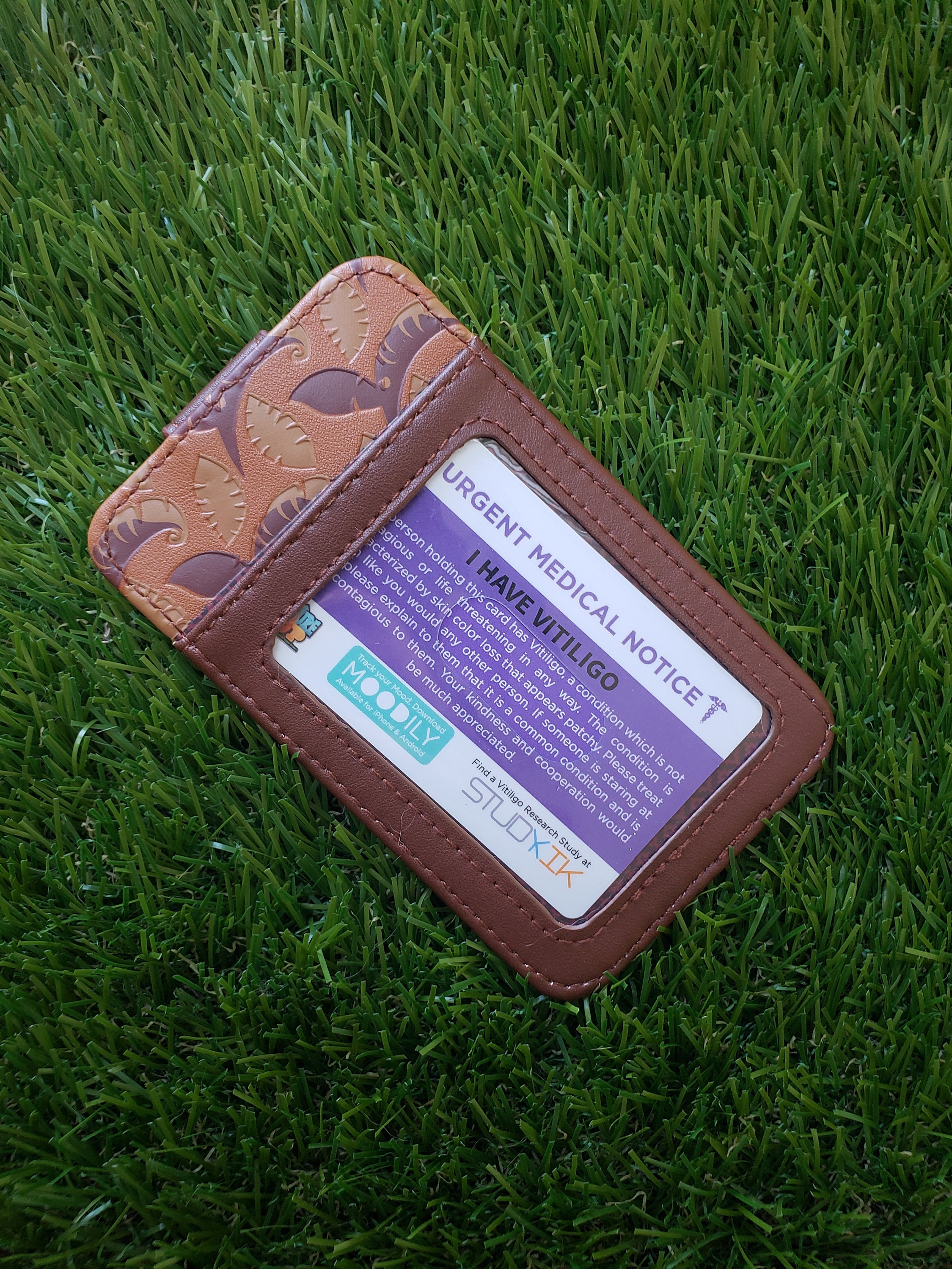 Vitiligo Card Vitiligo Emergency Card Vitiligo Medical Card | Etsy