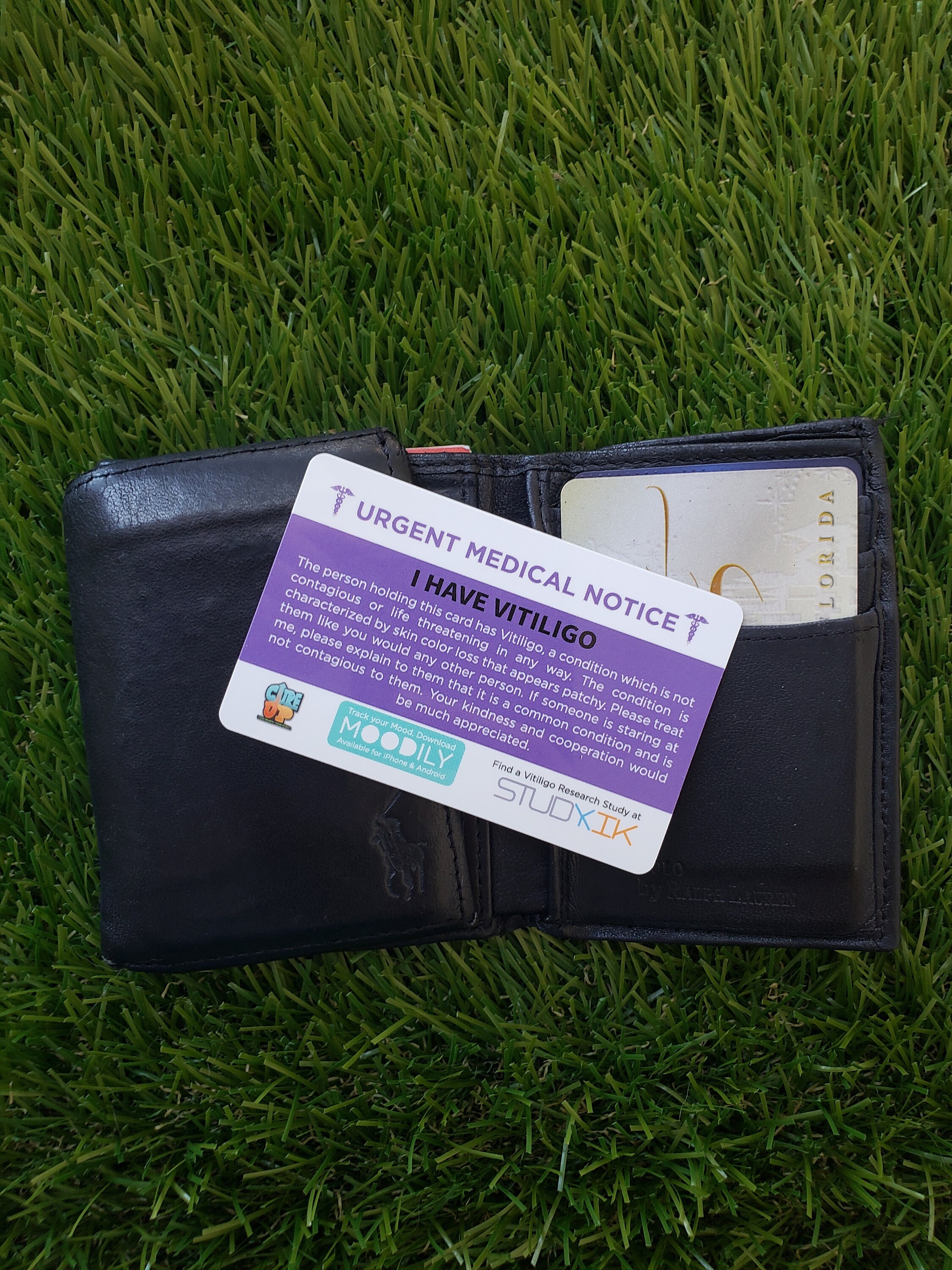 Vitiligo Card Vitiligo Emergency Card Vitiligo Medical Card | Etsy