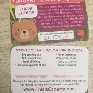 Child Eczema Card, Child Eczema Emergency Card, Child Eczema Medical ...