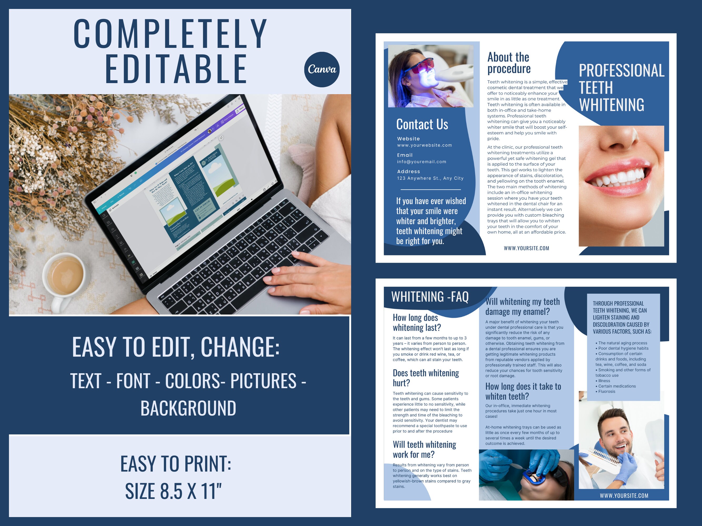 Printable Professional Teeth Whitening Trifold Brochure Template Canva ...
