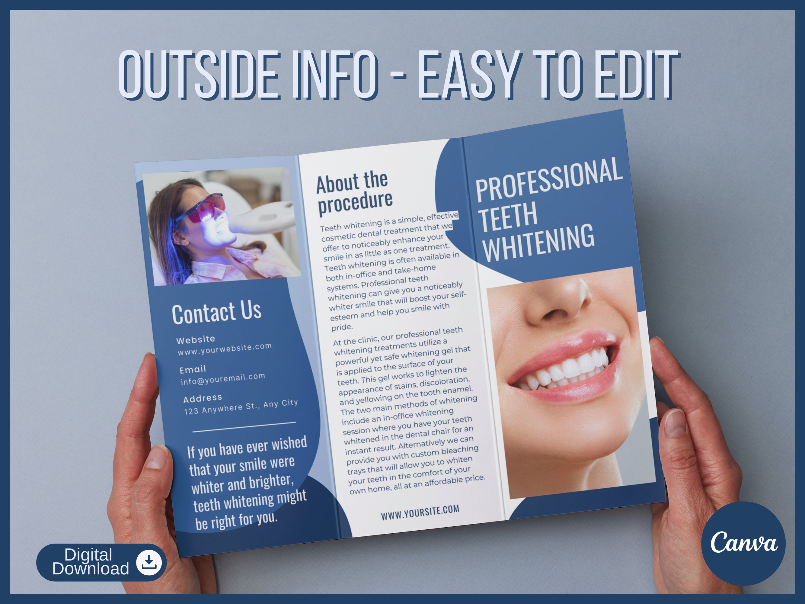 Printable Professional Teeth Whitening Trifold Brochure Template Canva ...