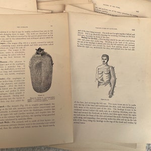 Antique 1901 Medical Book Pages, Large Paper Bundle for Crafts ...