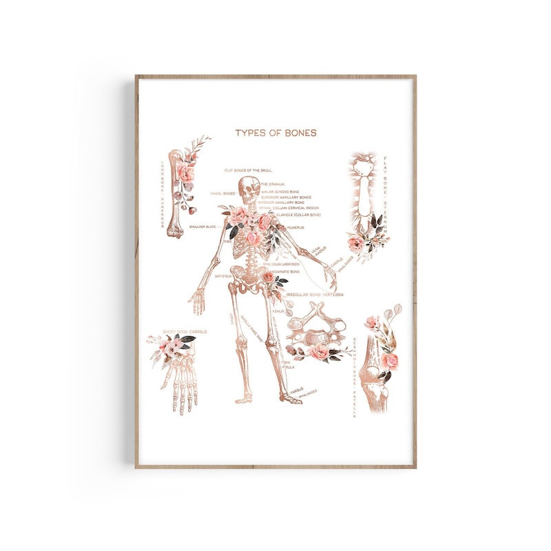 Orthopedic Poster - Etsy UK