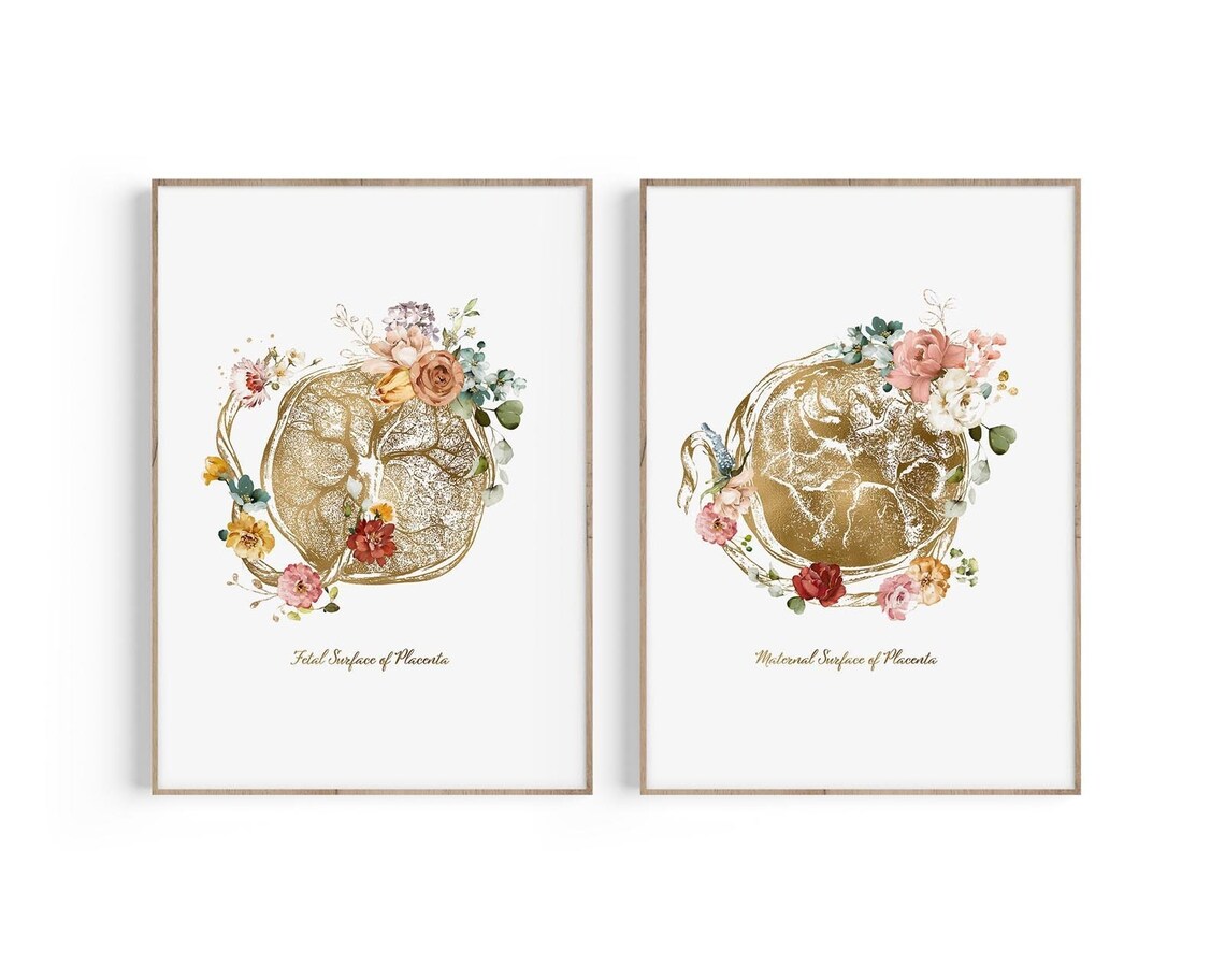 Placenta Anatomy Art Print, Maternal Fetal Development (digital ...