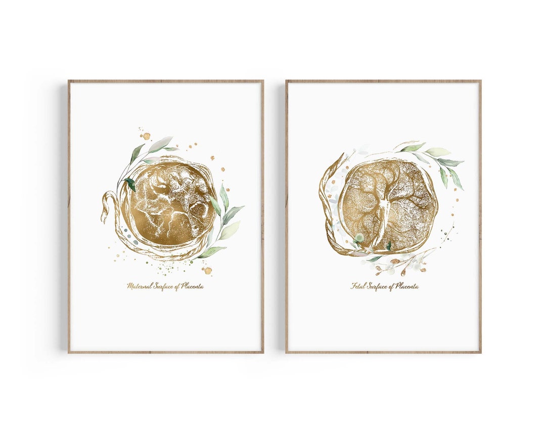Placenta Anatomy Art, Maternal Placenta, Fetal Placenta, Umbilical Cord ...