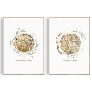 Placenta Anatomy Art, Maternal Placenta, Fetal Placenta, Umbilical Cord ...