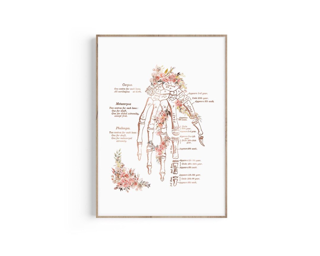 Hand Anatomy Art, Hand Skeletal Bones, Medical Poster, Hand Print ...