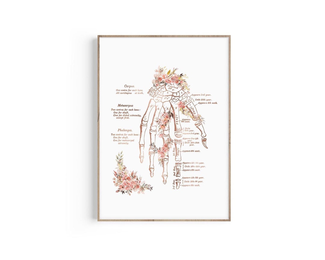 Hand Anatomy Art, Hand Skeletal Bones, Medical Poster, Hand Print ...