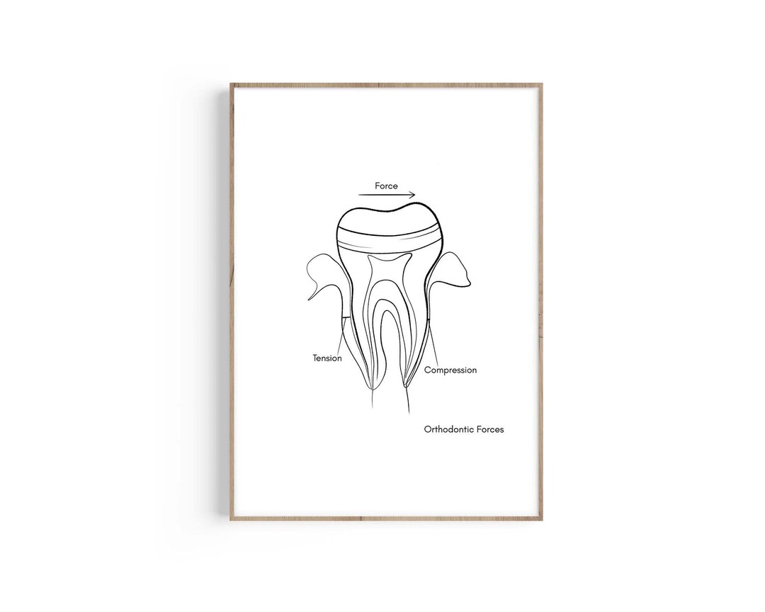 Orthodontic Forces, Braces Tools, Orthodontist Gift, Oral Anatomy ...