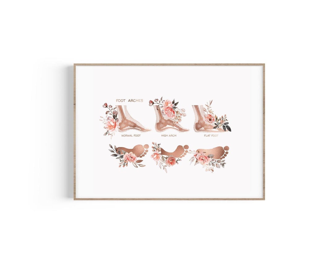 Foot Arches Print, Podiatrist Wall Art, Podiatrist Gift, DPM, Podiatry ...