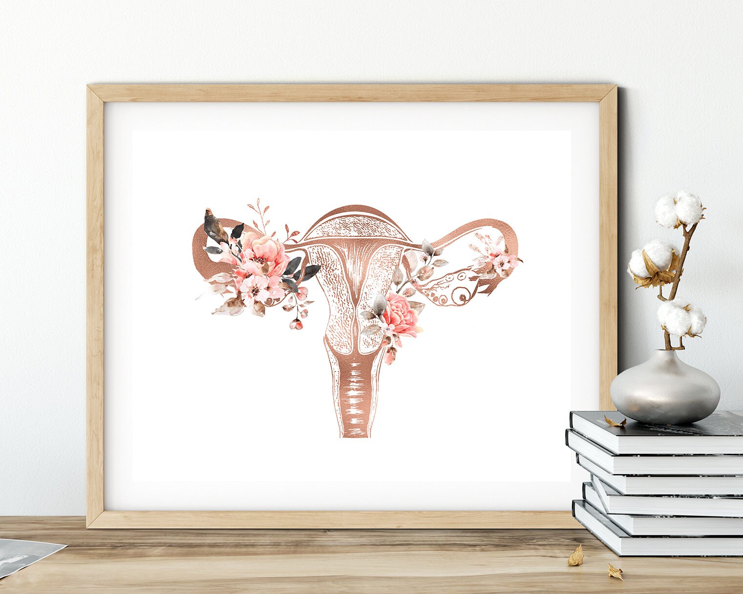 Uterus Anatomy Print Female Reproductive System Uterus Art | Etsy