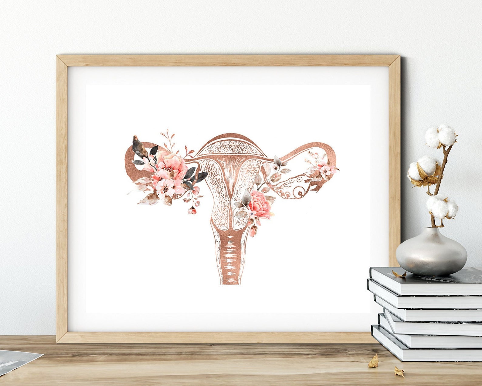 Uterus Anatomy Print Female Reproductive System Uterus Art - Etsy