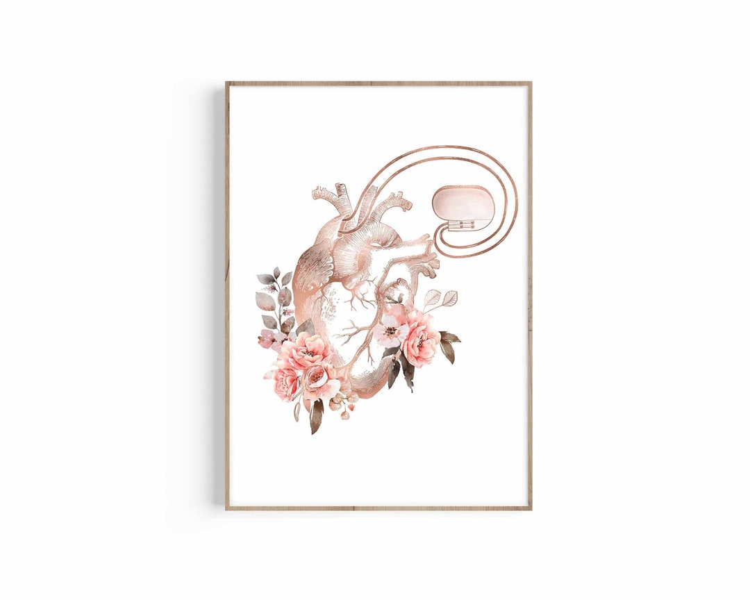 Heart Pacemaker Print, Heart Anatomy Poster, Anatomical Heart Art ...