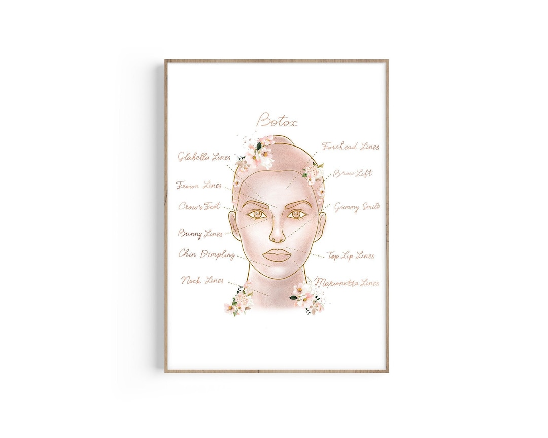 Botox Injection Points Print, Before and After, Plastic Surgeon Gift ...