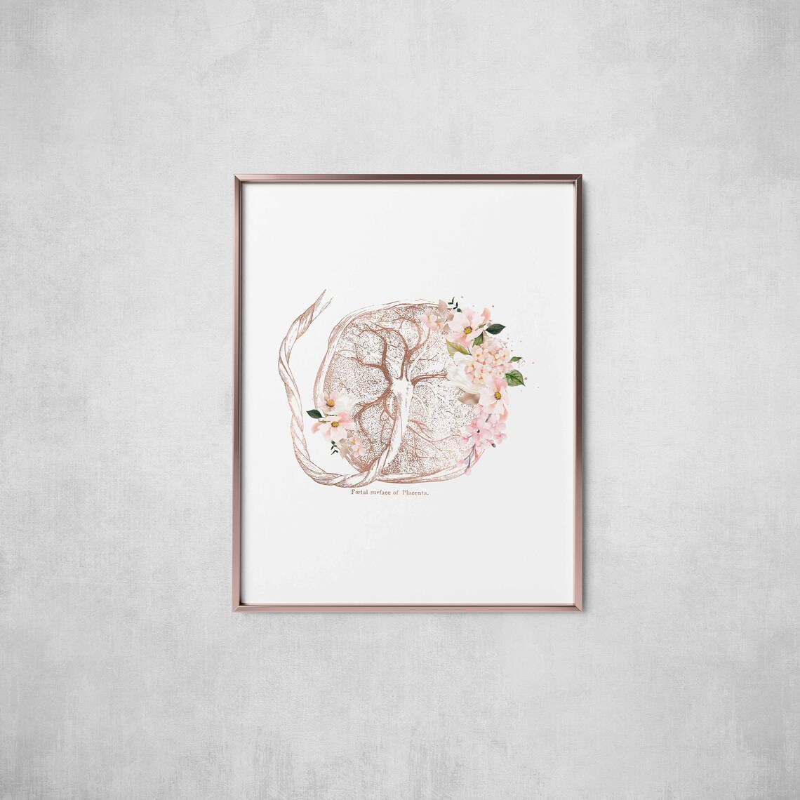 Placenta Fetus Pregnancy Art Womb Art Print Baby Art - Etsy