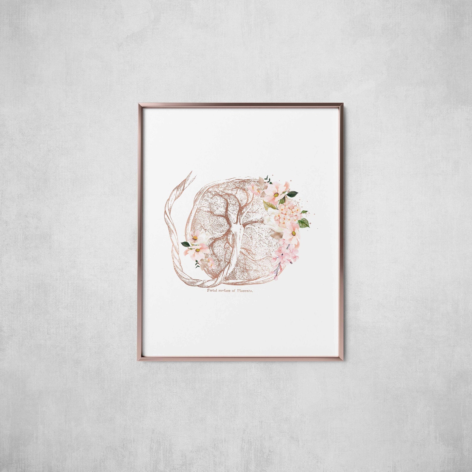 Placenta Fetus Pregnancy Art Womb Art Print Baby Art - Etsy