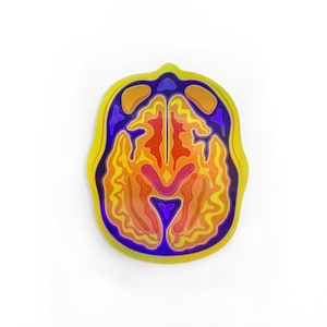 HOLOGRAPHIC Brain MRI/CT Vinyl Sticker | Anatomical Neuro Art - Etsy