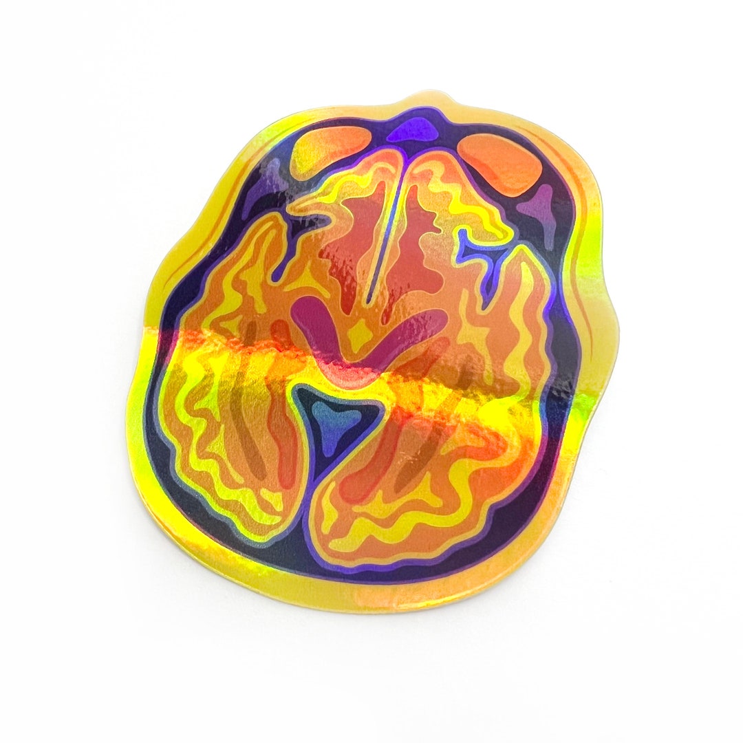 HOLOGRAPHIC Brain MRI/CT Vinyl Sticker | Anatomical Neuro Art - Etsy