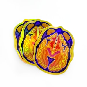 HOLOGRAPHIC Brain MRI/CT Vinyl Sticker | Anatomical Neuro Art - Etsy