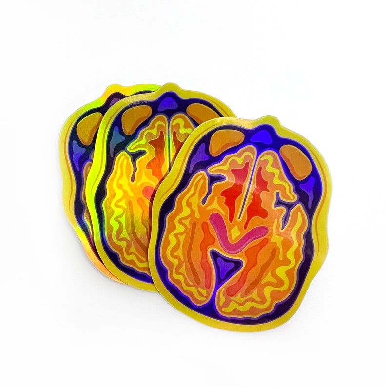 HOLOGRAPHIC Brain MRI/CT Vinyl Sticker | Anatomical Neuro Art - Etsy