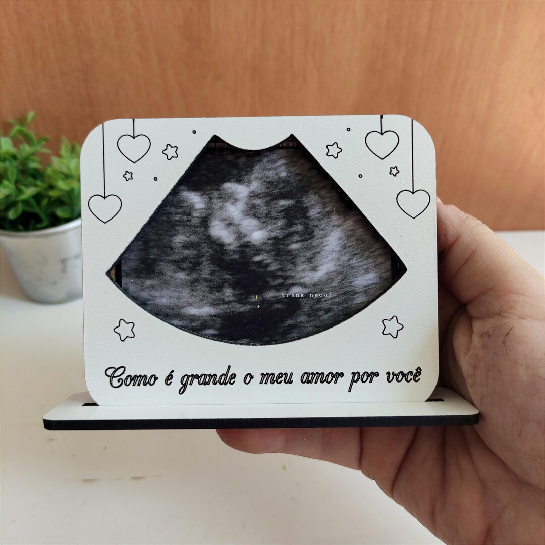 USG Instant Download | Ultrasound Vector Kit Laser Cut, Glowforge ...