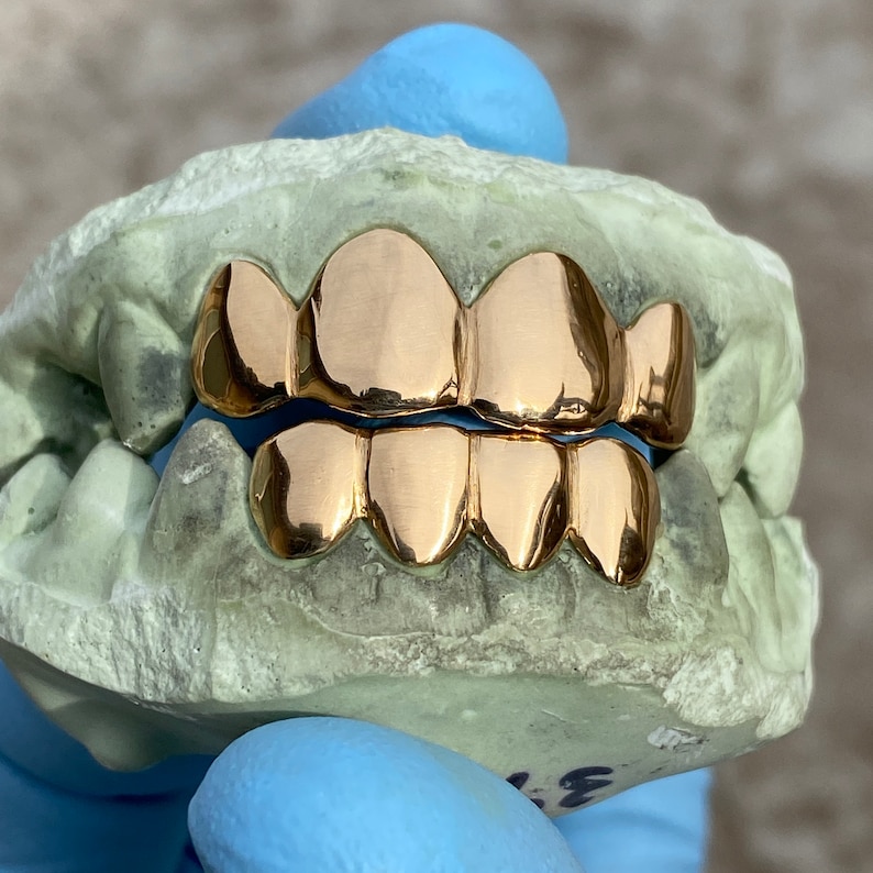 Real Solid 22K Gold Custom Grillz Teeth Grills or Single One Tooth Cap ...