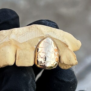 Solid Gold Nugget Grillz: Custom Single Tooth Cap (10K, 14K, 18K) - Etsy