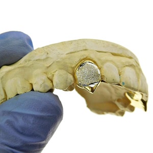 10K Gold OR 14K Gold Custom Fang Grillz Set Diamond Dust 2-tone 2 Single Cap Vampire Canine ...