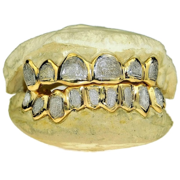 Two Front Gold Teeth - Etsy
