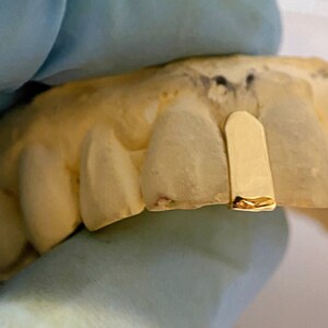 Real Solid 10K Gold or 14K or 18K Gold Single Gap Grill Custom Fit ...