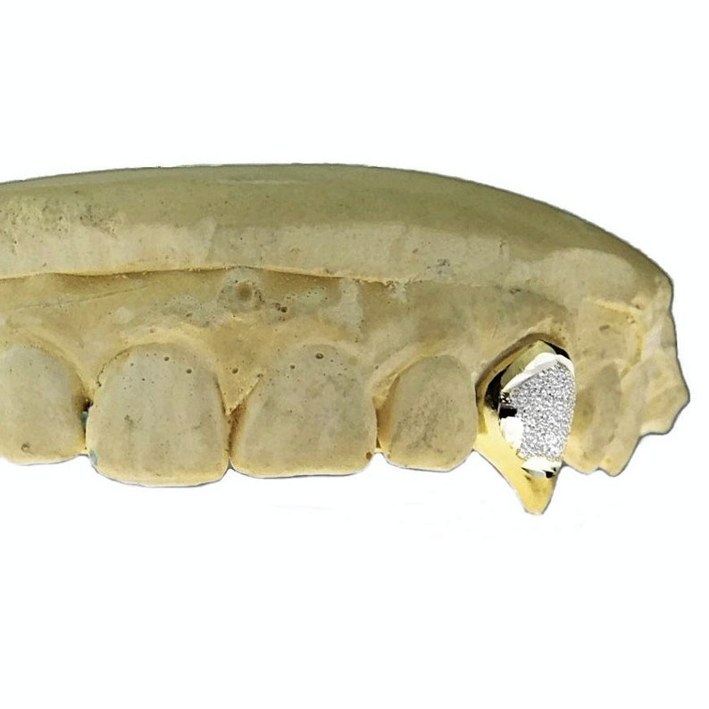 Solid 10K or 14K Gold Single Fang Cap Real Custom Grillz - Etsy