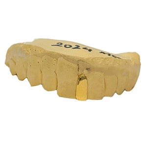 Real Solid 10K Gold or 14K or 18K Gold Single Gap Grill Custom Fit ...