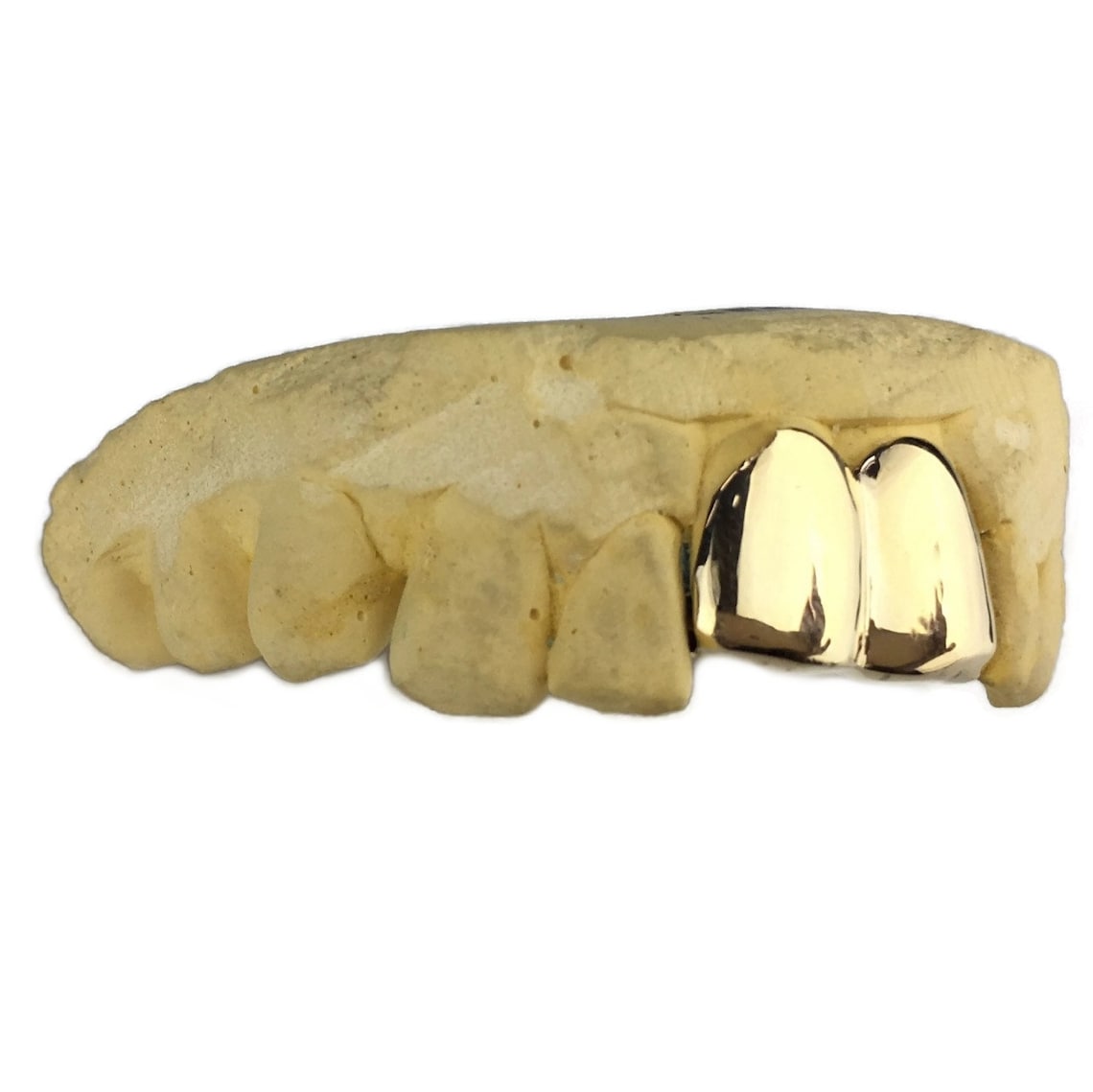 10K Gold Custom Grillz: Two Front Teeth Double Cap - Etsy