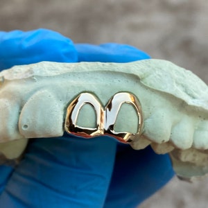 Solid 10k/14k Gold Canine Teeth Grillz - Custom Open Face Double Caps ...
