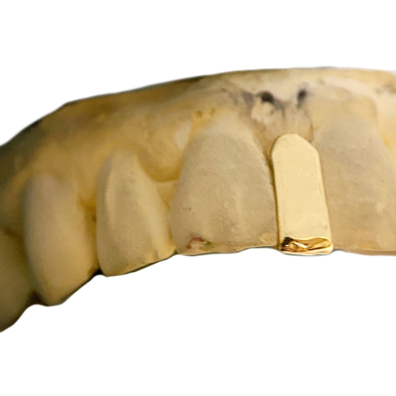 Gap Filler Custom Grillz - Etsy