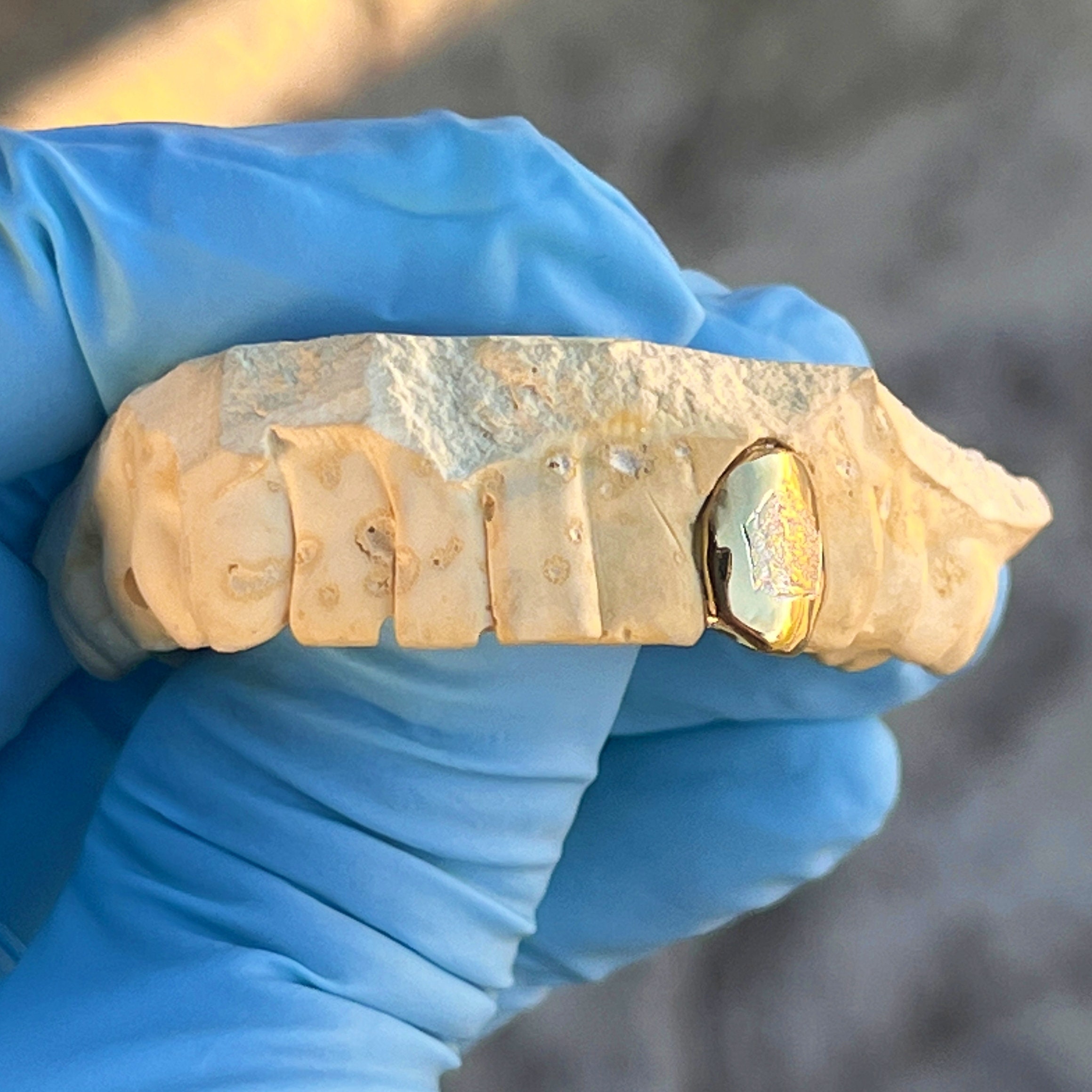 10K/14K Gold Diamond Dust Grillz - Custom Single Tooth Cap - Etsy