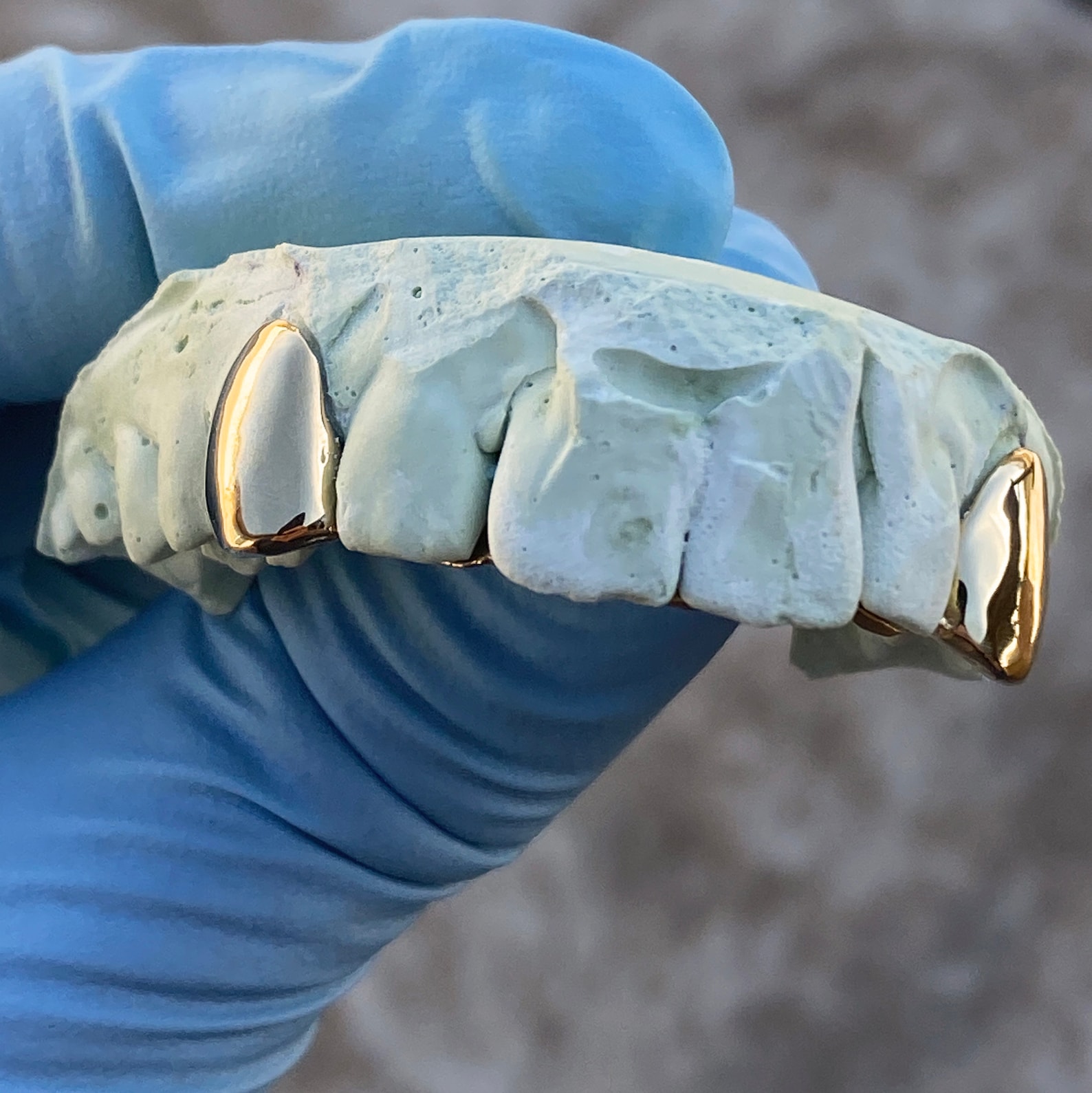 Gold Plated Custom Fitted Single Cap Grillz Set Real 925 - Etsy