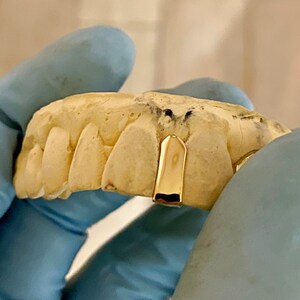 Real Solid 10K Gold or 14K or 18K Gold Single Gap Grill Custom Fit ...