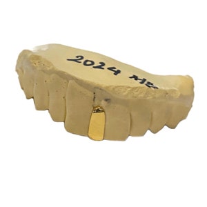 Real Solid 10K Gold or 14K or 18K Gold Single Gap Grill Custom Fit ...