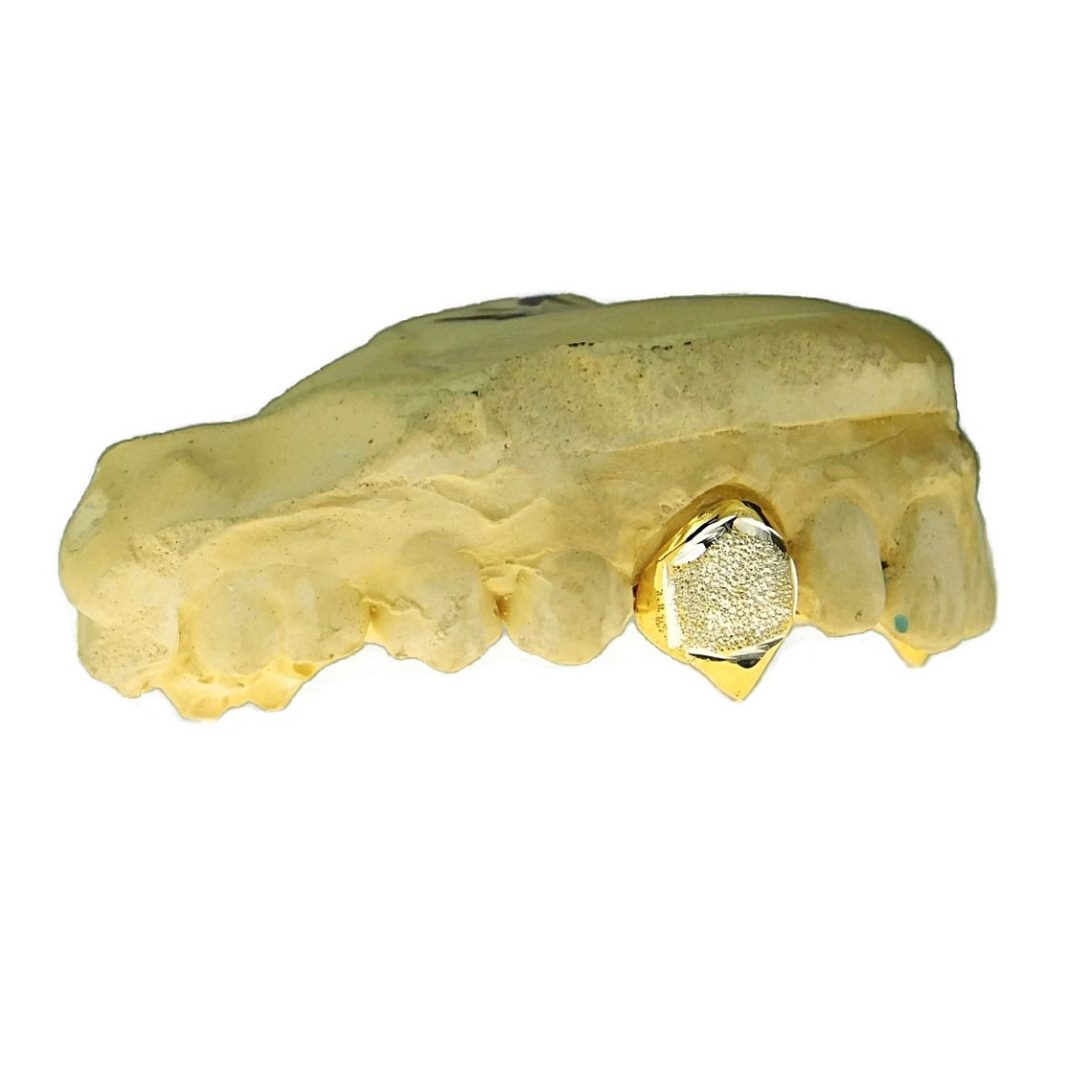 10K Gold OR 14K Gold Custom Fang Grillz Set Diamond Dust - Etsy