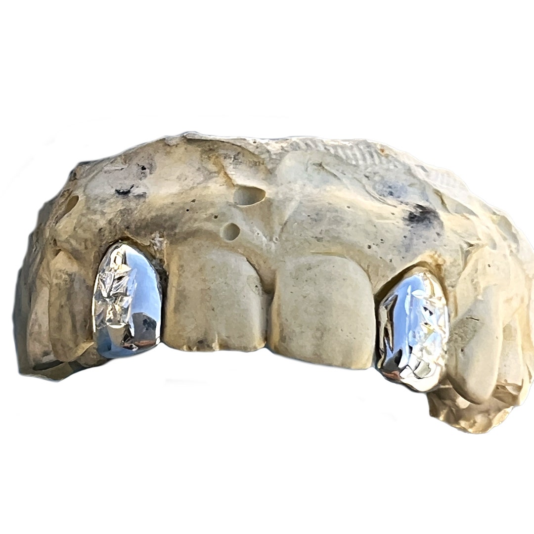 925 Sterling Silver Custom Fitted Single Tooth Starburst Design Caps ...