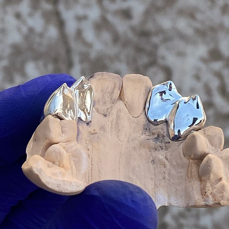 925 Sterling Silver Custom Fang Grillz Set Double Fangs Caps | Etsy