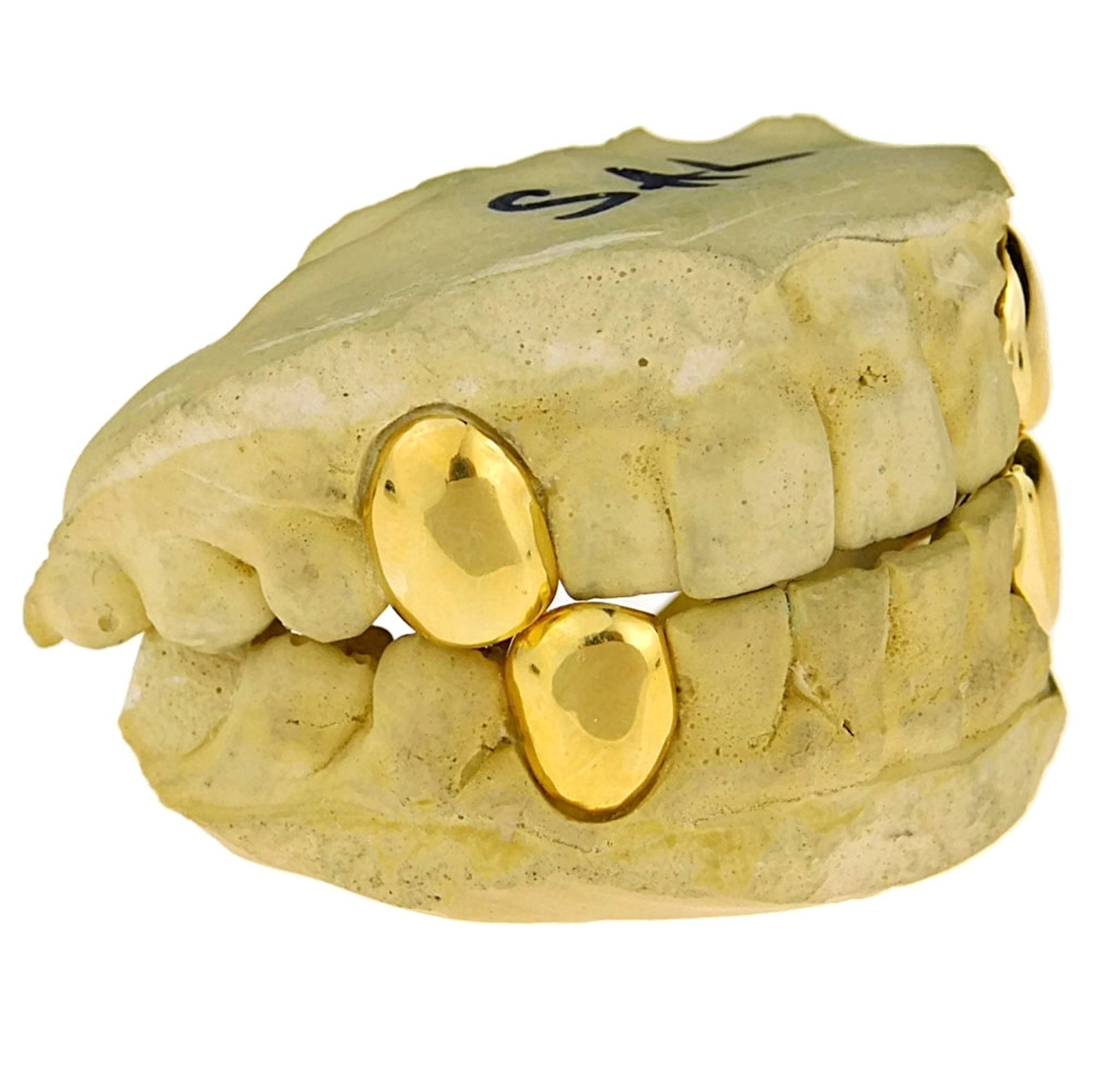 Solid 10K Gold or 14K Gold 4 Custom Fitted Single Cap Grillz - Etsy