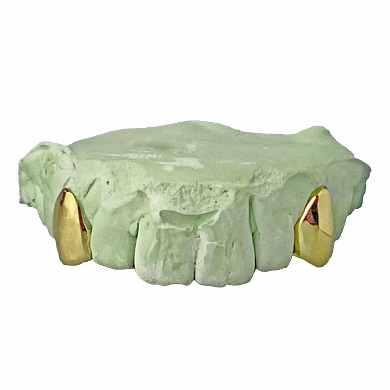 Gold Plated Custom Fitted Single Cap Grillz Set Real 925 - Etsy