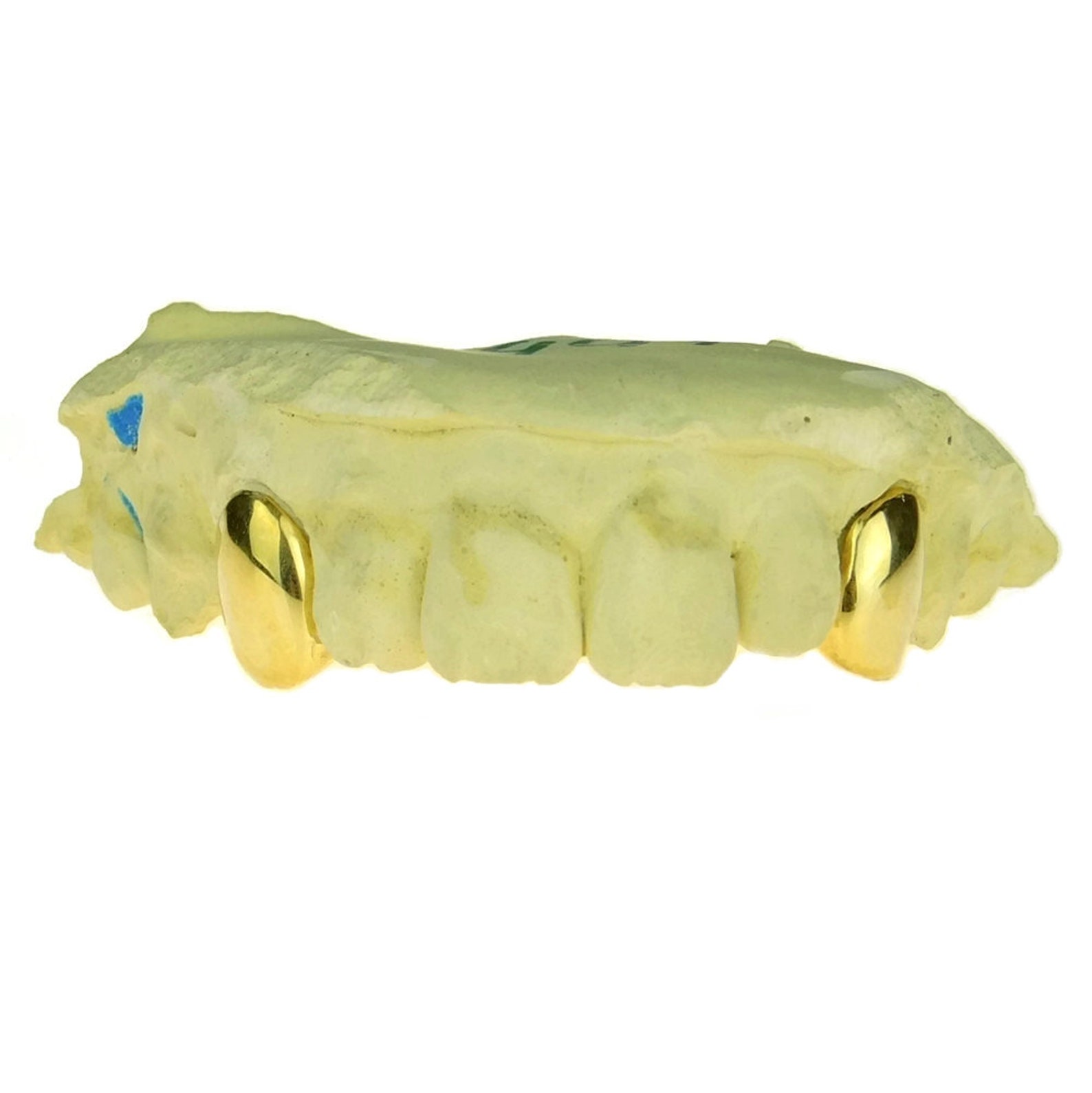 Gold Plated Custom Fitted Single Cap Grillz Set Real 925 - Etsy