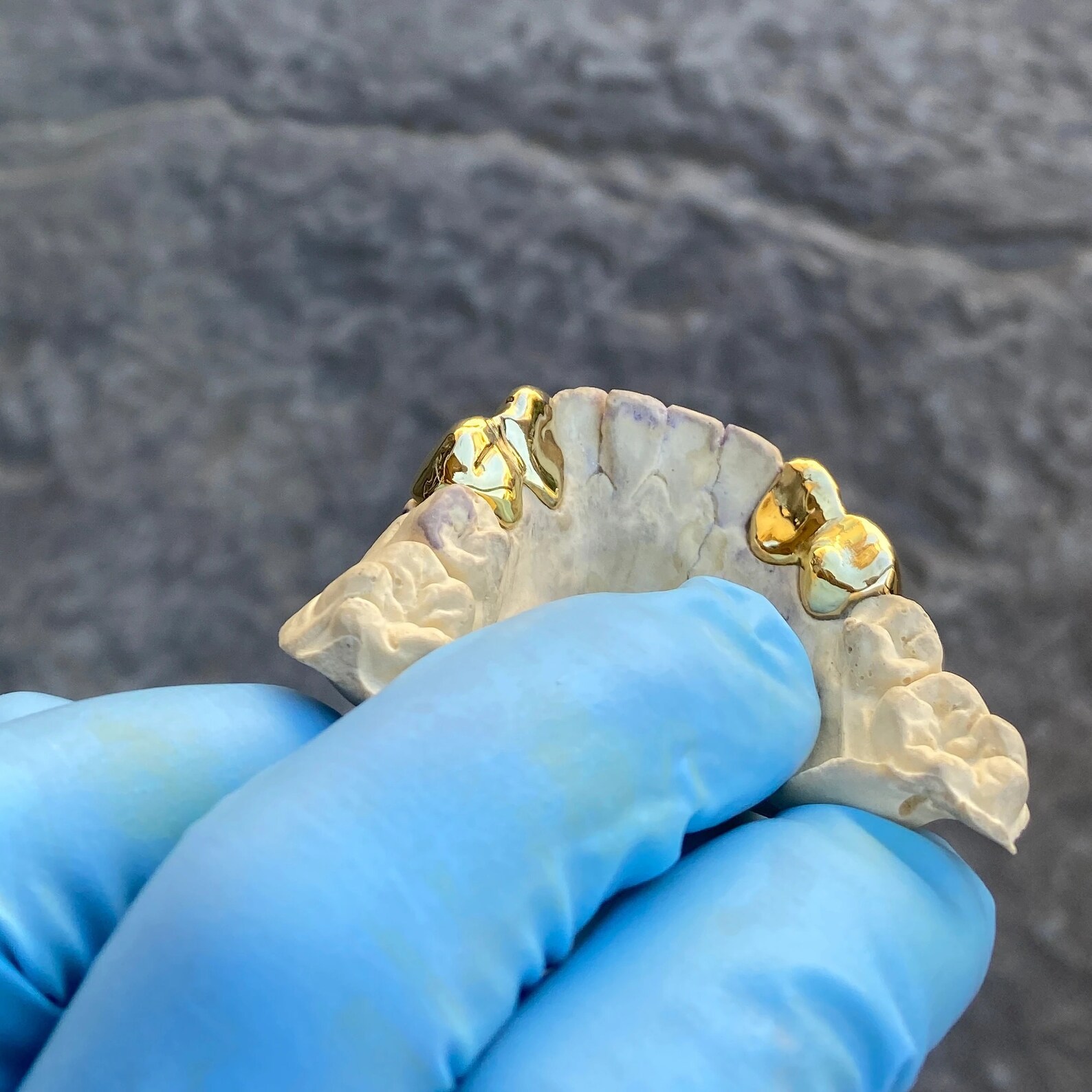 Real Solid 10K Gold Double Side Canine Teeth Custom Grillz - Etsy
