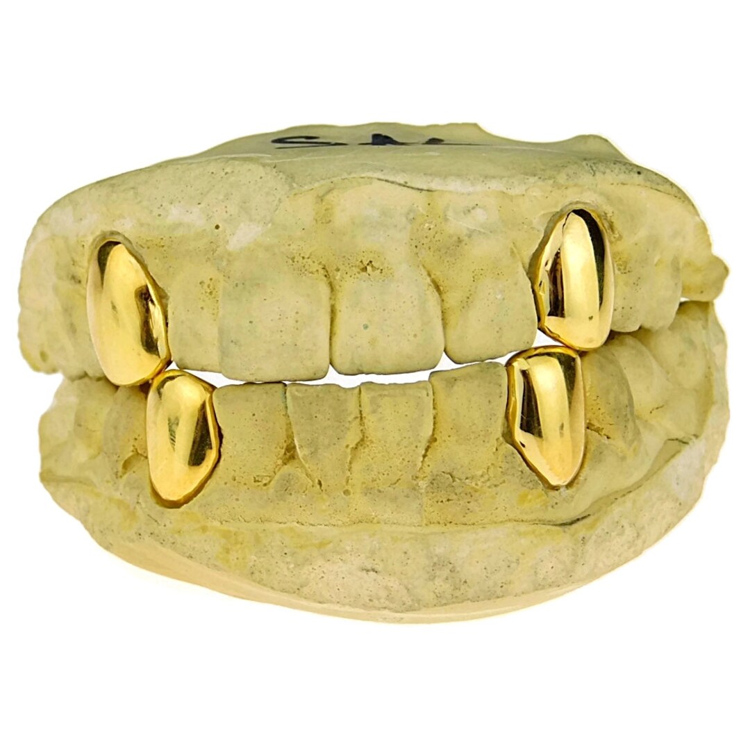 10K/14K Gold Custom Canine Teeth Grillz Set With Hidden Bar - Etsy