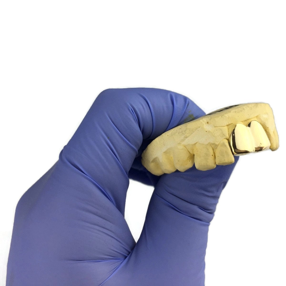 10K Gold Custom Grillz: Two Front Teeth Double Cap - Etsy